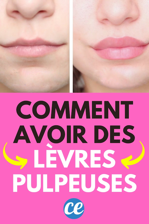 Comment Avoir des Lèvres Pulpeuses Naturellement ? 12 Astuces Qui Marchent.
