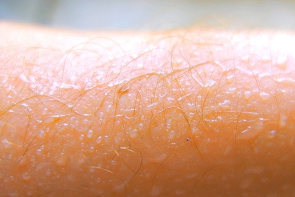 Boutons Sur les Fesses : 9 Astuces Pour les Éliminer à Tout Jamais.