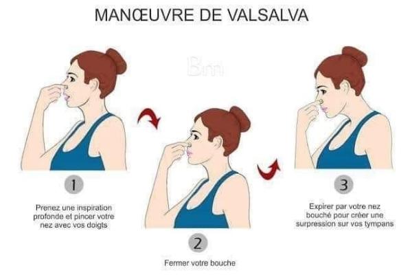 Oreille bouchée : 10 remèdes naturels pour la déboucher rapidement