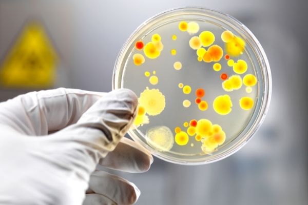 Pourquoi Je Fais Caca Vert ? 6 Causes des Selles Vertes.