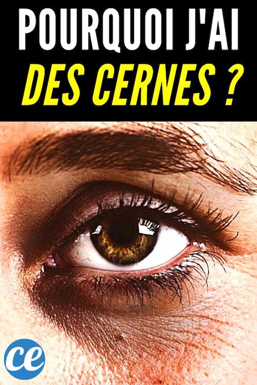 Pourquoi J'ai des Cernes Sous les Yeux Alors Que Je Dors