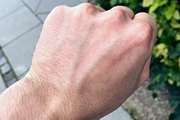 Pourquoi Certaines Personnes Ont les Veines Apparentes