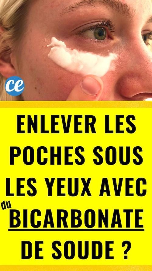Comment Enlever les Poches Sous les Yeux Avec du Bicarbonate de Soude