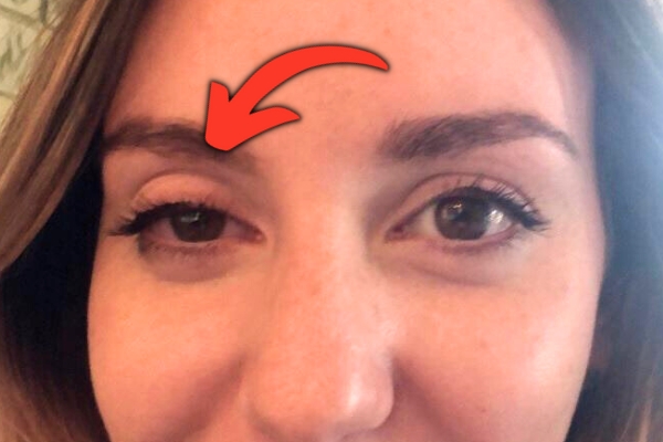 5 Remèdes Naturels Contre les Paupières Tombantes.