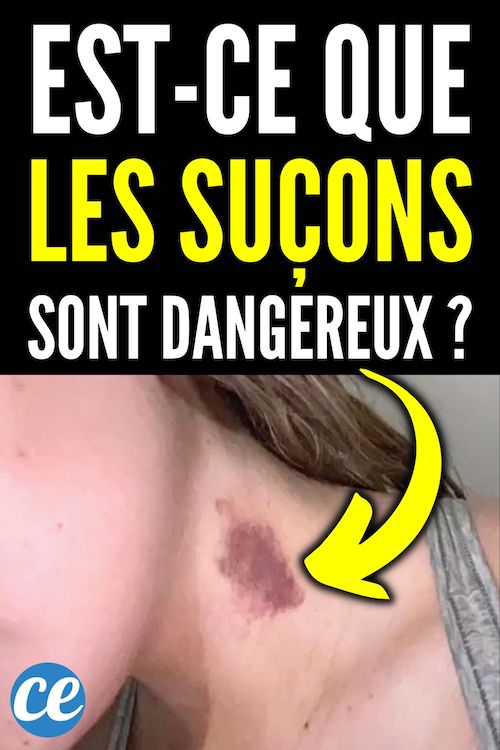 Les Suçons Sont-ils Dangereux