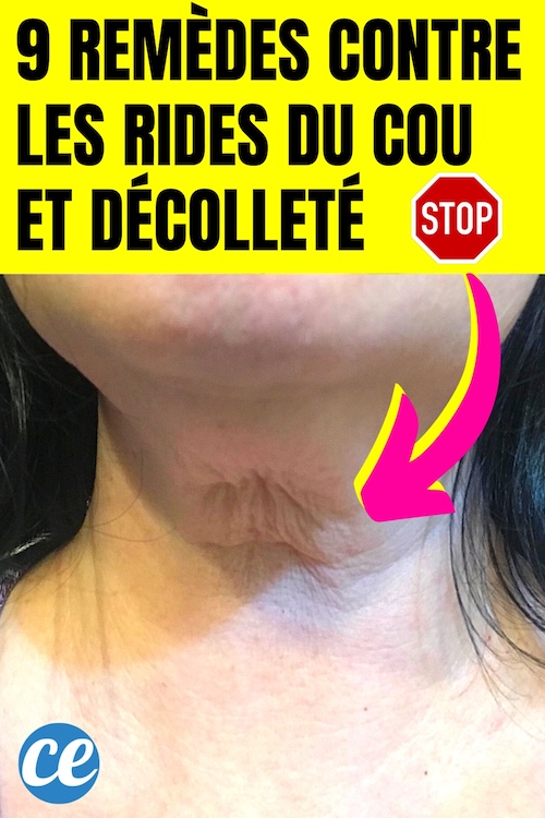 9 Traitements Naturelles Contre les Rides du Cou et du Décolleté.