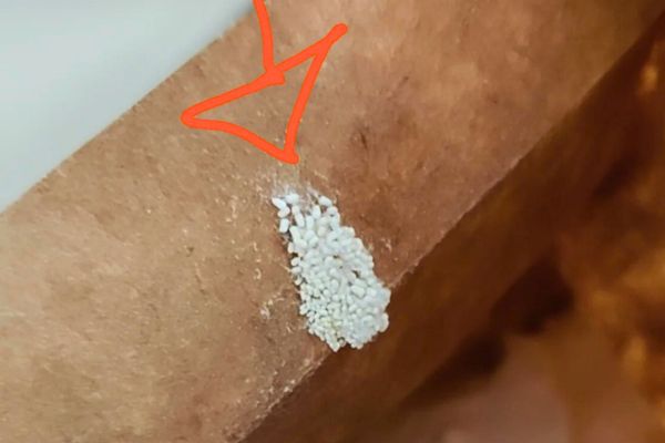 Acarien de Cuisine ou Ciron : Comment Éliminer ces Petites Bêtes Blanches