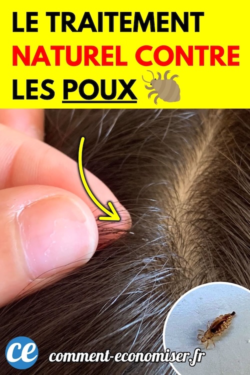 Comment Lutter contre les Poux Naturellement ? Ma Recette Maison.