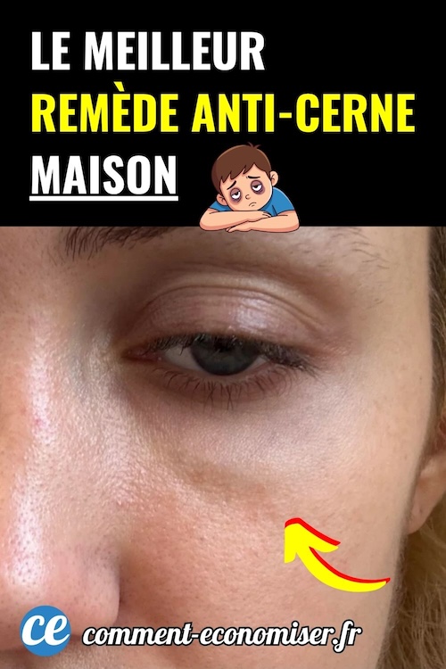 Une Astuce Anti-Cernes Naturelle, Efficace et Gratuite.