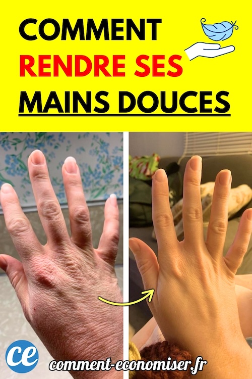 L'astuce étonnante pour adoucir ses mains naturellement en 2 min