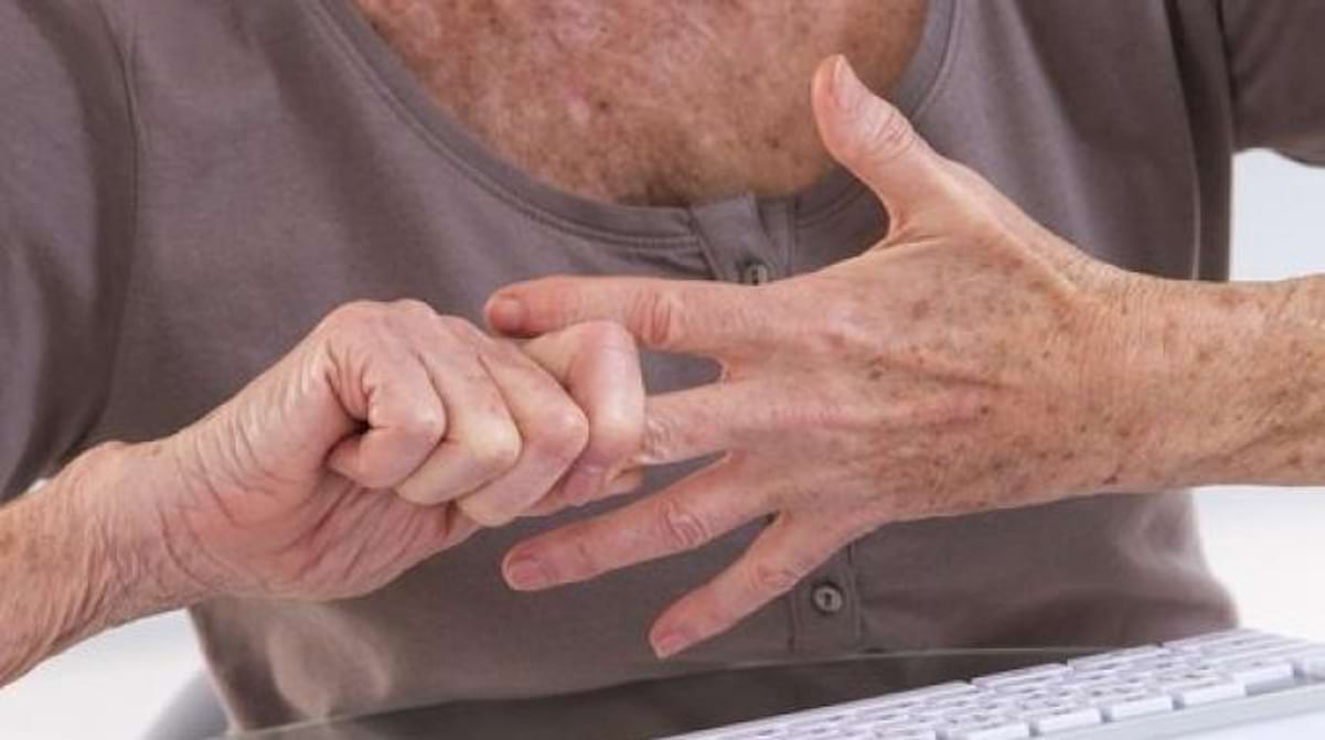 6 Remèdes pour Soulager l'Arthrose et Toute Douleur Inflammatoire.